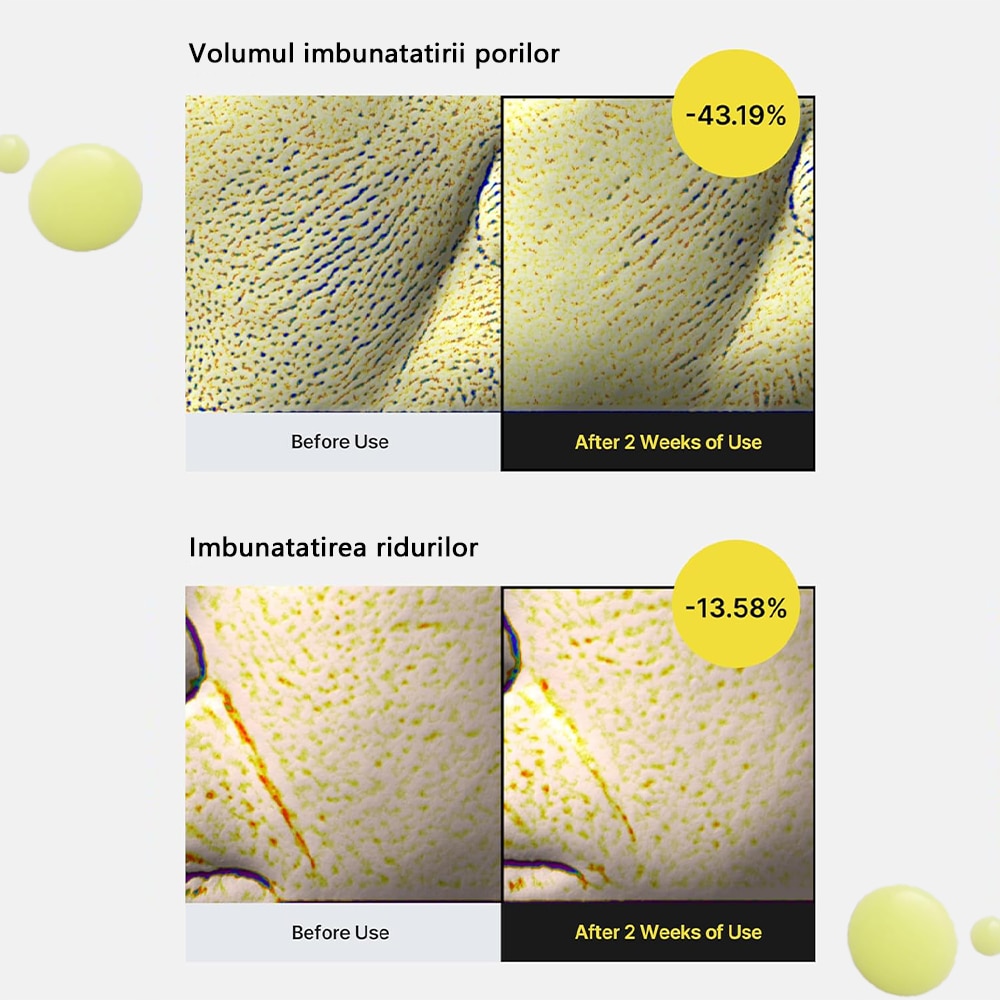 Serul Vita A Retinol Shot Tightening, cu Vitamina A, Retinol, Peptide ...