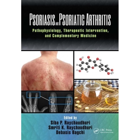 Psoriasis and Psoriatic Arthritis: Pathophysiology, Therapeutic ...