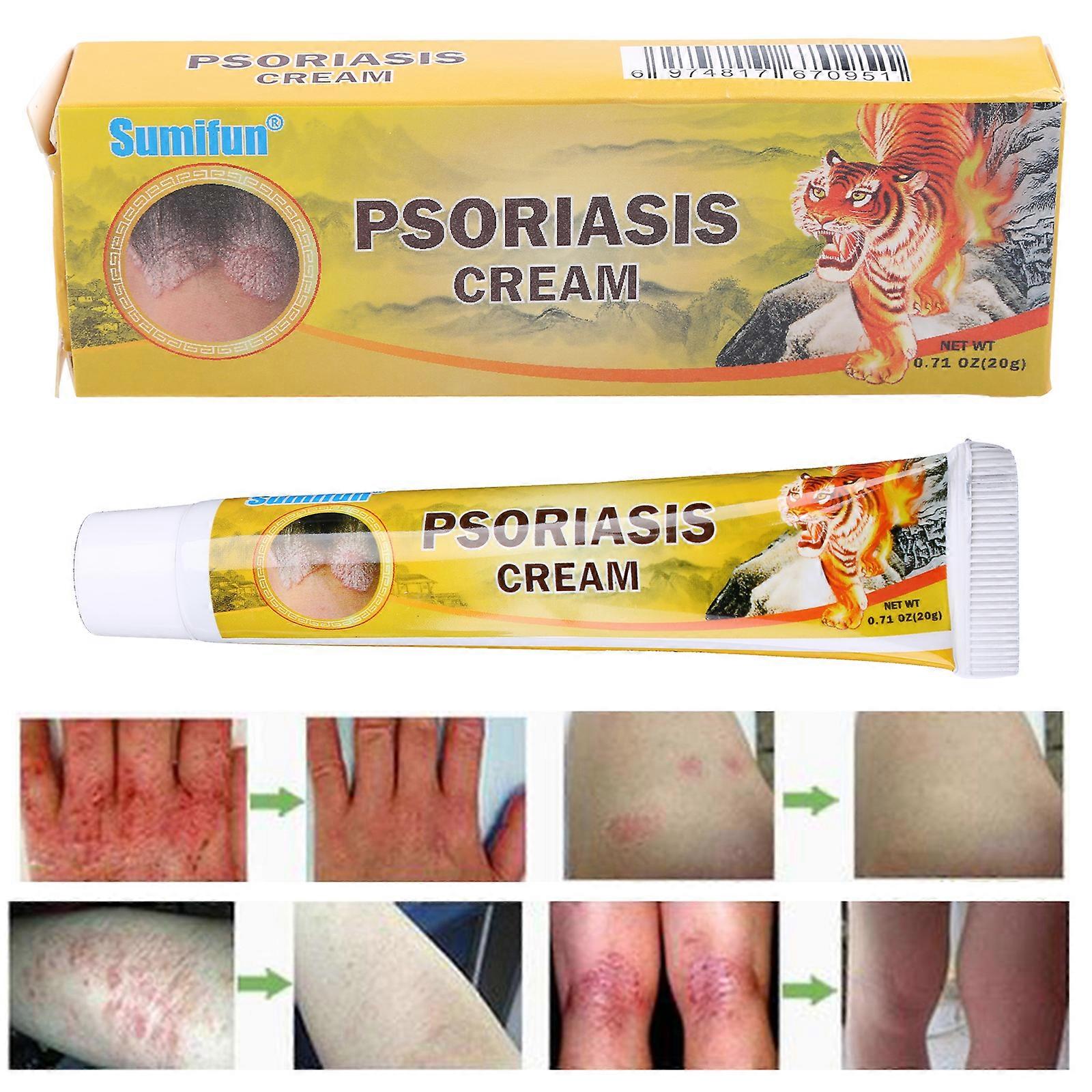 Crema pentru Psoriazis/Eczema/Dermatita, Sumifun, 20ml, Antibacteriana ...