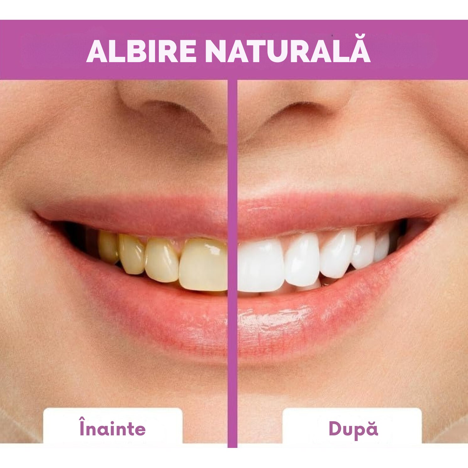 Set benzi albire dinti, 14 tratamente (28 benzi), fara peroxid, albire ...
