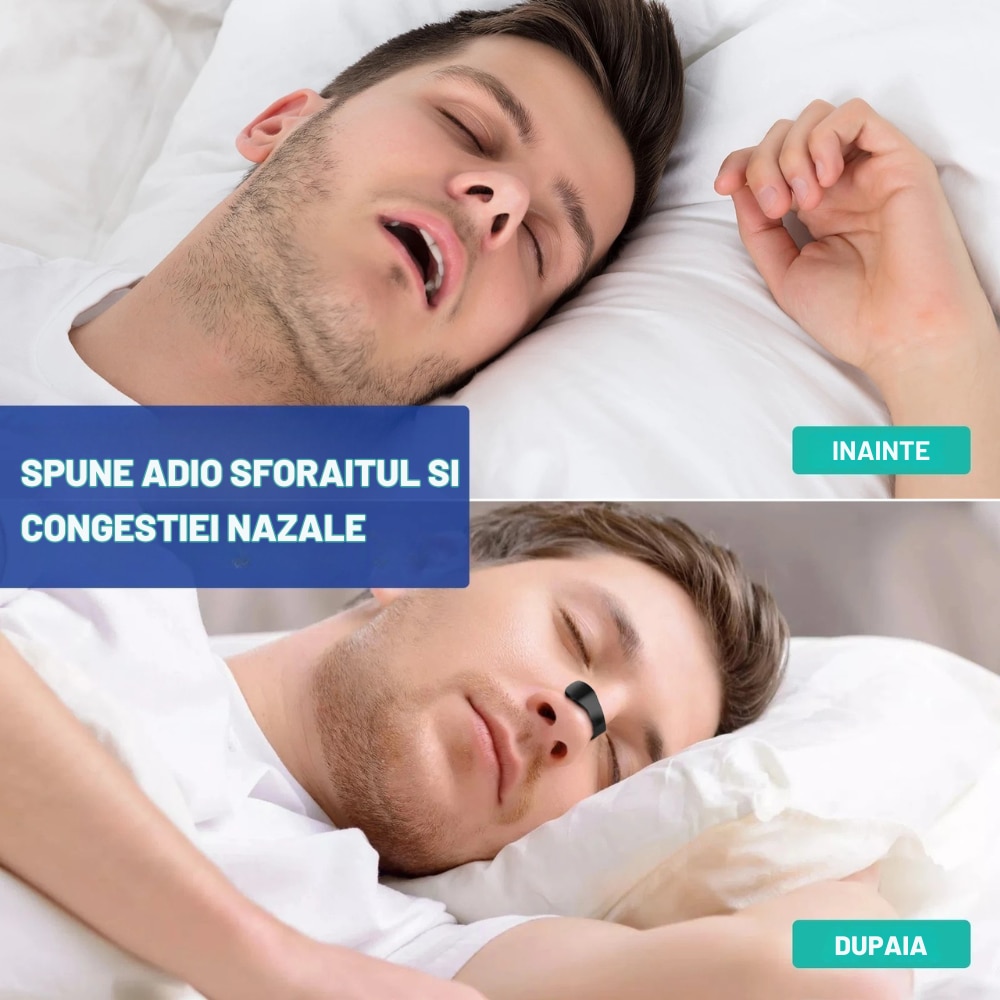Dilatator Nazal Magnetic Binovation, 4 Benzi Magnetice, 60 Plasturi ...