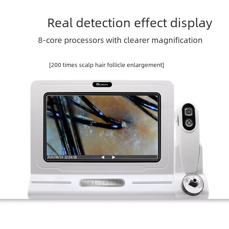 Aparat de analiza scalp, cu camera HD, design integrat, spectru de ...