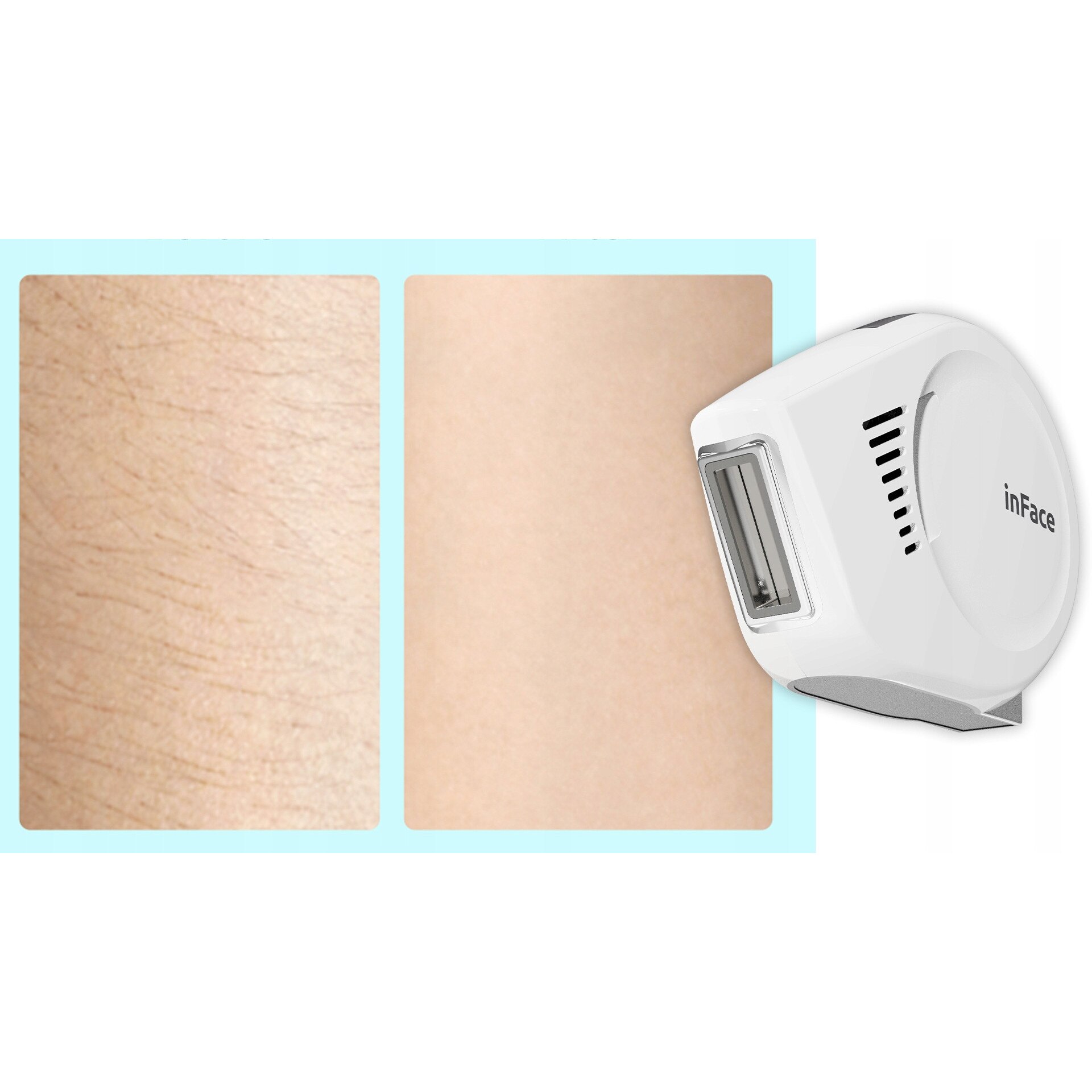Epilator IPL inFace, ZH-01F, 5 trepte de putere, tehnologie sigura ...