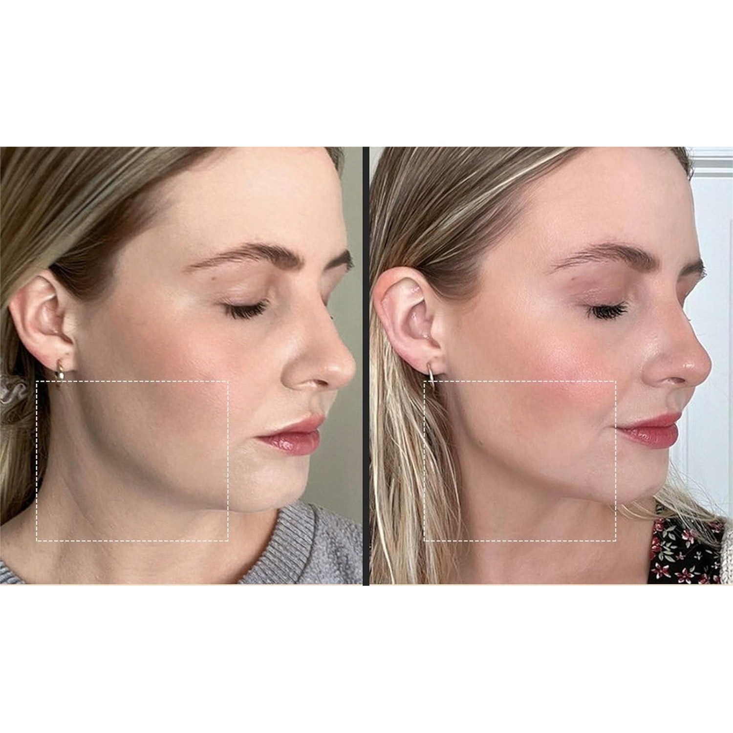 Aparat de lifting facial AMIRO R1 Pro RF 4in1, RF, EMS, LED, IR - eMAG.ro