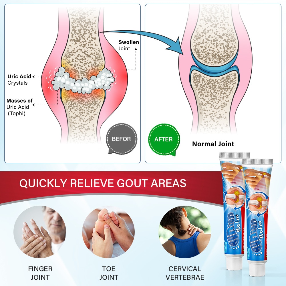 Crema pentru dureri de guta si monturi, Sumifun, 20g - eMAG.ro
