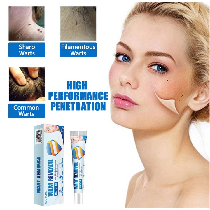 Crema pentru negi, unisex, pentru maini picioare fata axile gat, 30ml ...
