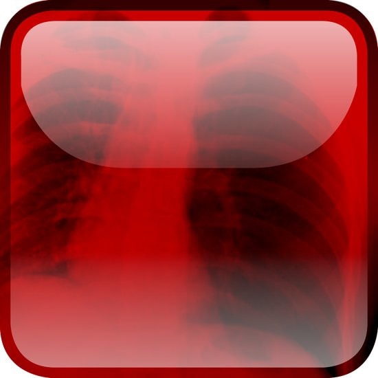 Mayo Clinic Internal Medicine Board Review de Robert D. Ficalora - eMAG.ro