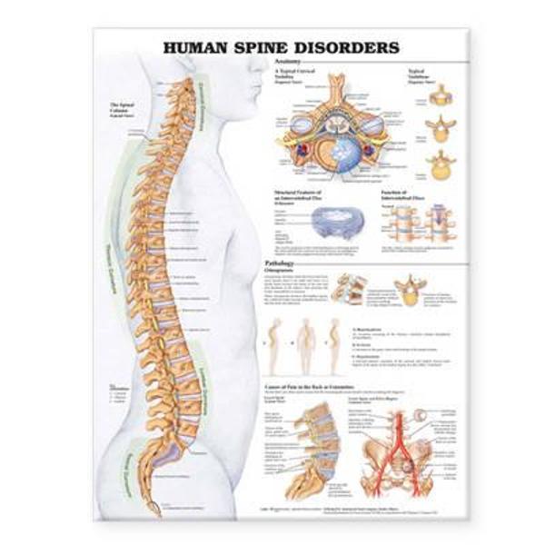Human Spine Disorders Anatomical Chart - eMAG.ro