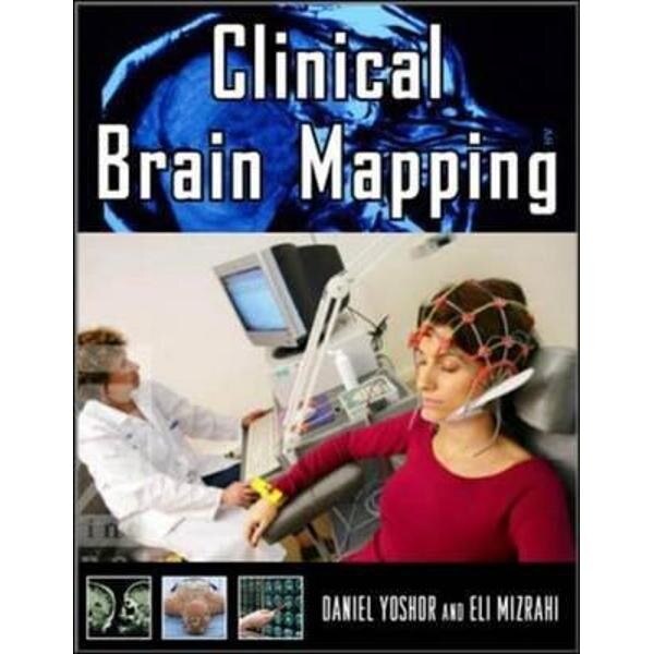 Clinical Brain Mapping - eMAG.ro