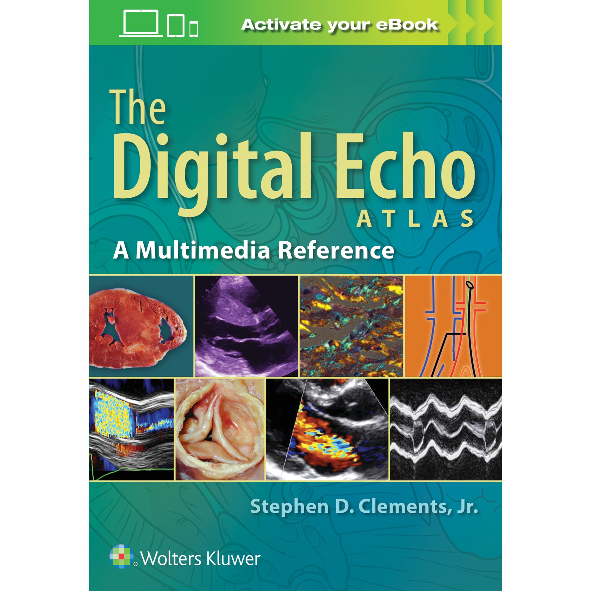 The Digital Echo Atlas de Stephen D. Clements, Jr. MD - eMAG.ro