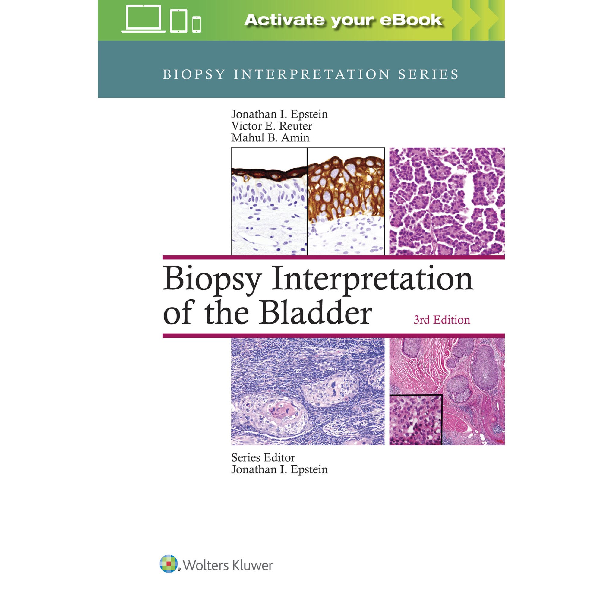 Biopsy Interpretation of the Bladder de Jonathan Epstein MD - eMAG.ro