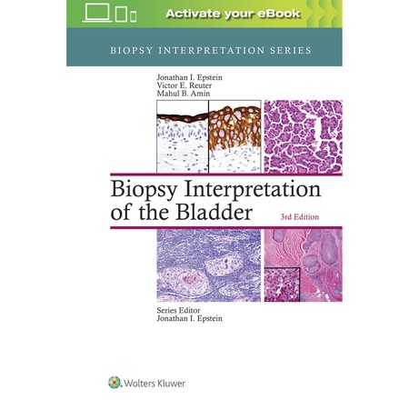 Biopsy Interpretation of the Bladder de Jonathan Epstein MD - eMAG.ro