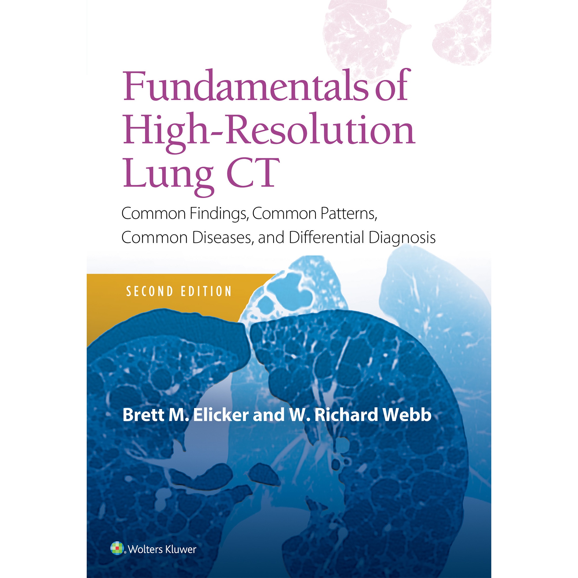 Fundamentals of High-Resolution Lung CT de Brett M Elicker MD - eMAG.ro