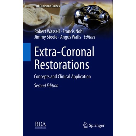Extra-Coronal Restorations de Robert Wassell - eMAG.ro