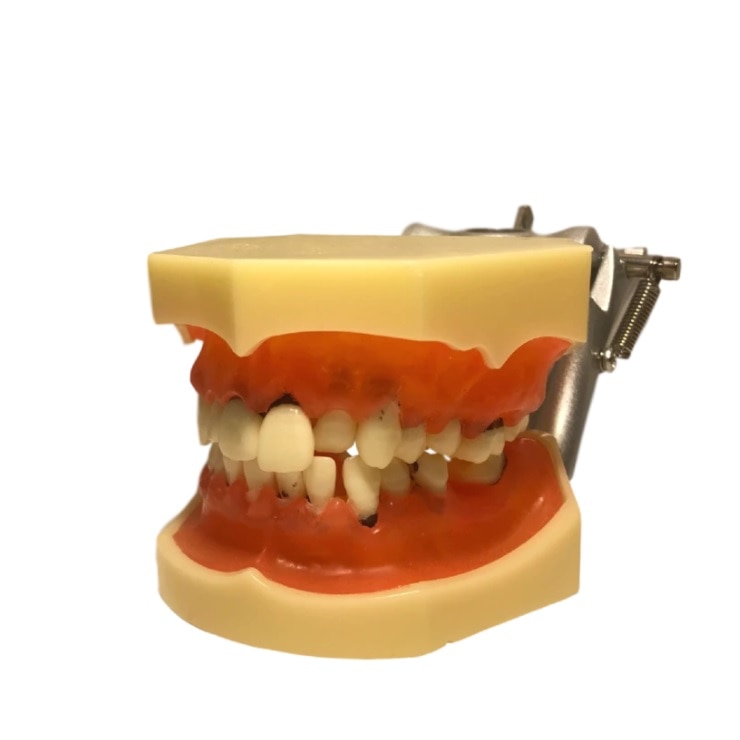 Model boala parodontala fara dinti detasabili pentru practica medicina ...