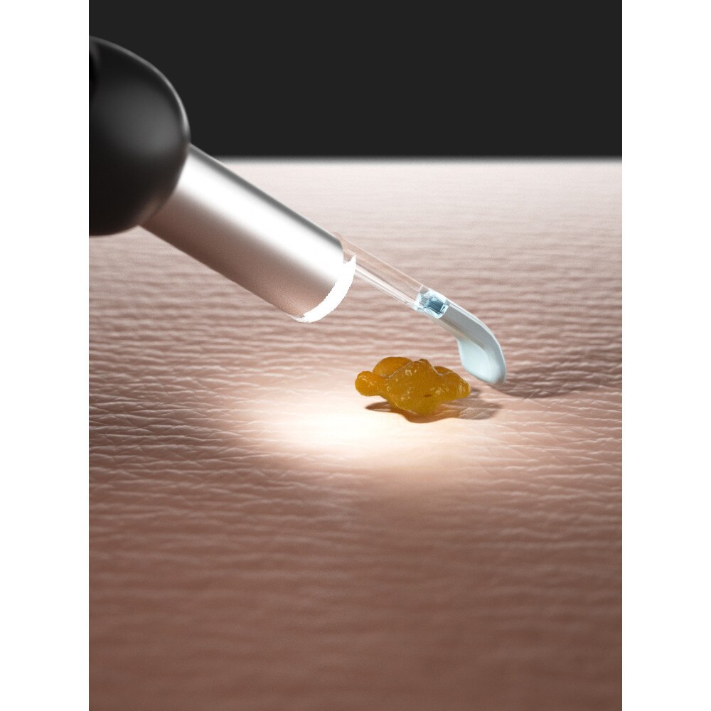 Otoscop cu camera Bebird A2, Silver - eMAG.ro