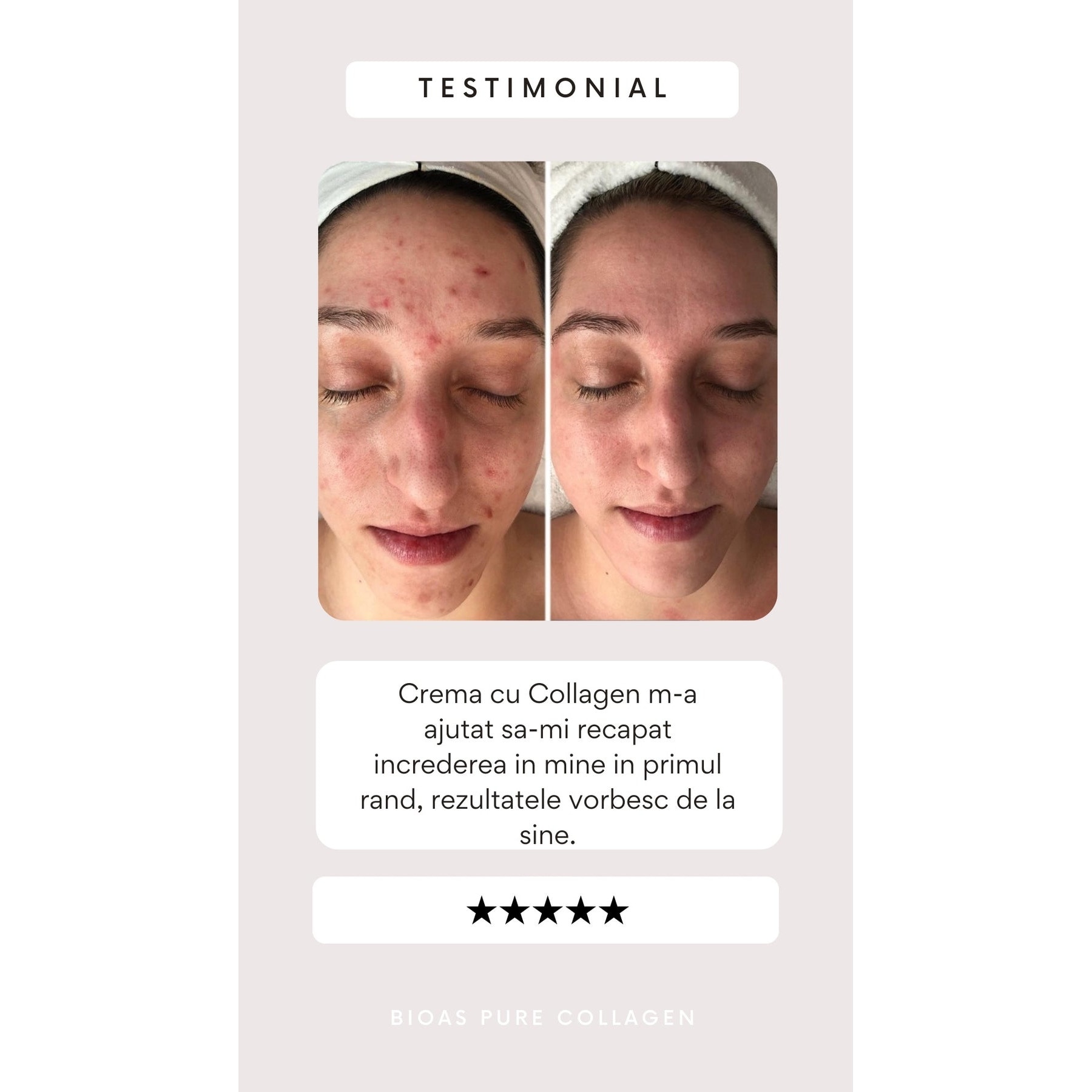 Crema anti-acnee cu colagen 3 in 1 50g - eMAG.ro