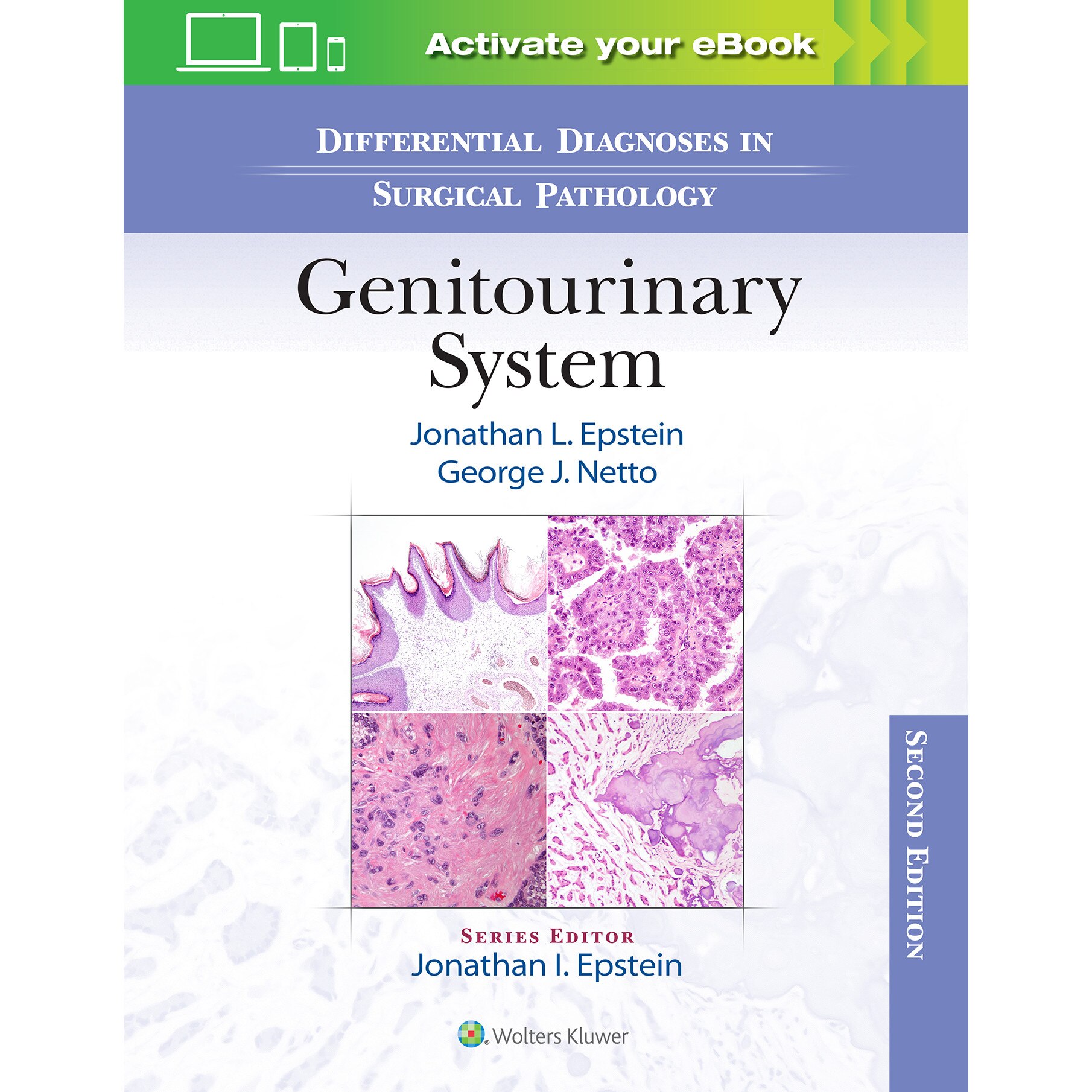 Differential Diagnoses in Surgical Pathology: Genitourinary System de ...