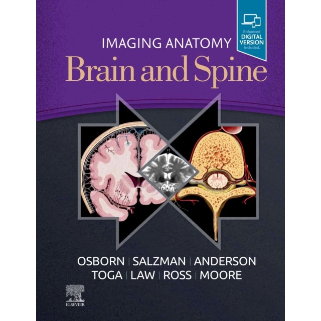 Imaging Anatomy Brain and Spine de Anne G. Osborn - eMAG.ro