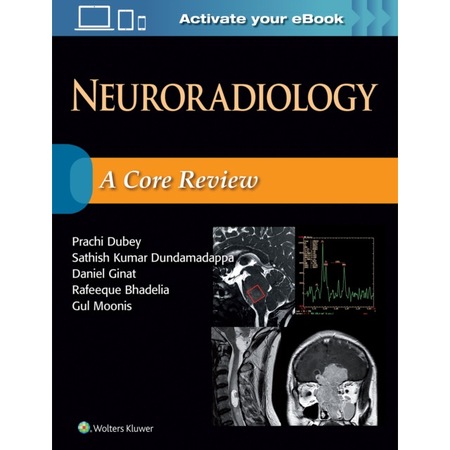 Neuroradiology: A Core Review de Prachi Dubey MD - eMAG.ro