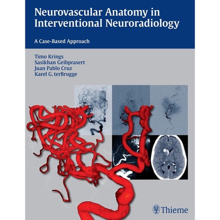Neurovascular Anatomy in Interventional Neuroradiology: A Case-Based ...