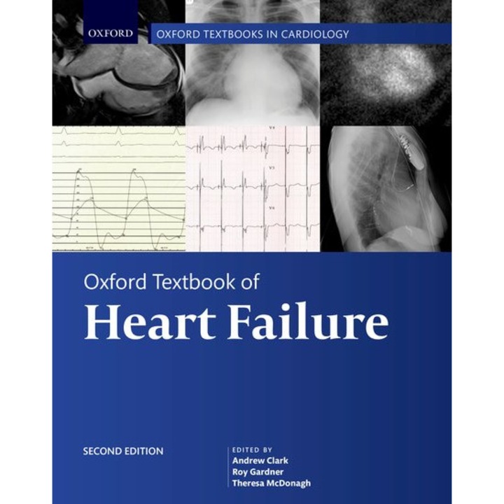 Oxford Textbook of Heart Failure de Andrew Clark - eMAG.ro