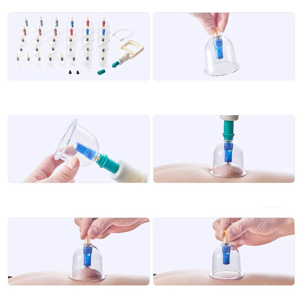 Set 12 Ventuze de Masaj Zenino® - Pompa Vacuum, Anticelulita, Terapie ...