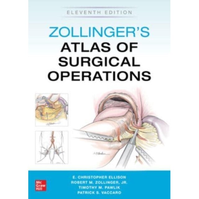 Zollinger's Atlas of Surgical Operations, Eleventh Edition de Robert ...