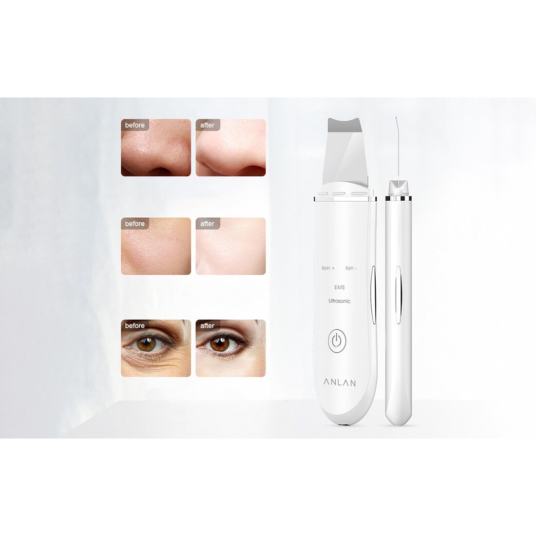 Шпатула ANLAN за лице, Йонизираща, Ултразвукова, Бял - eMAG.bg