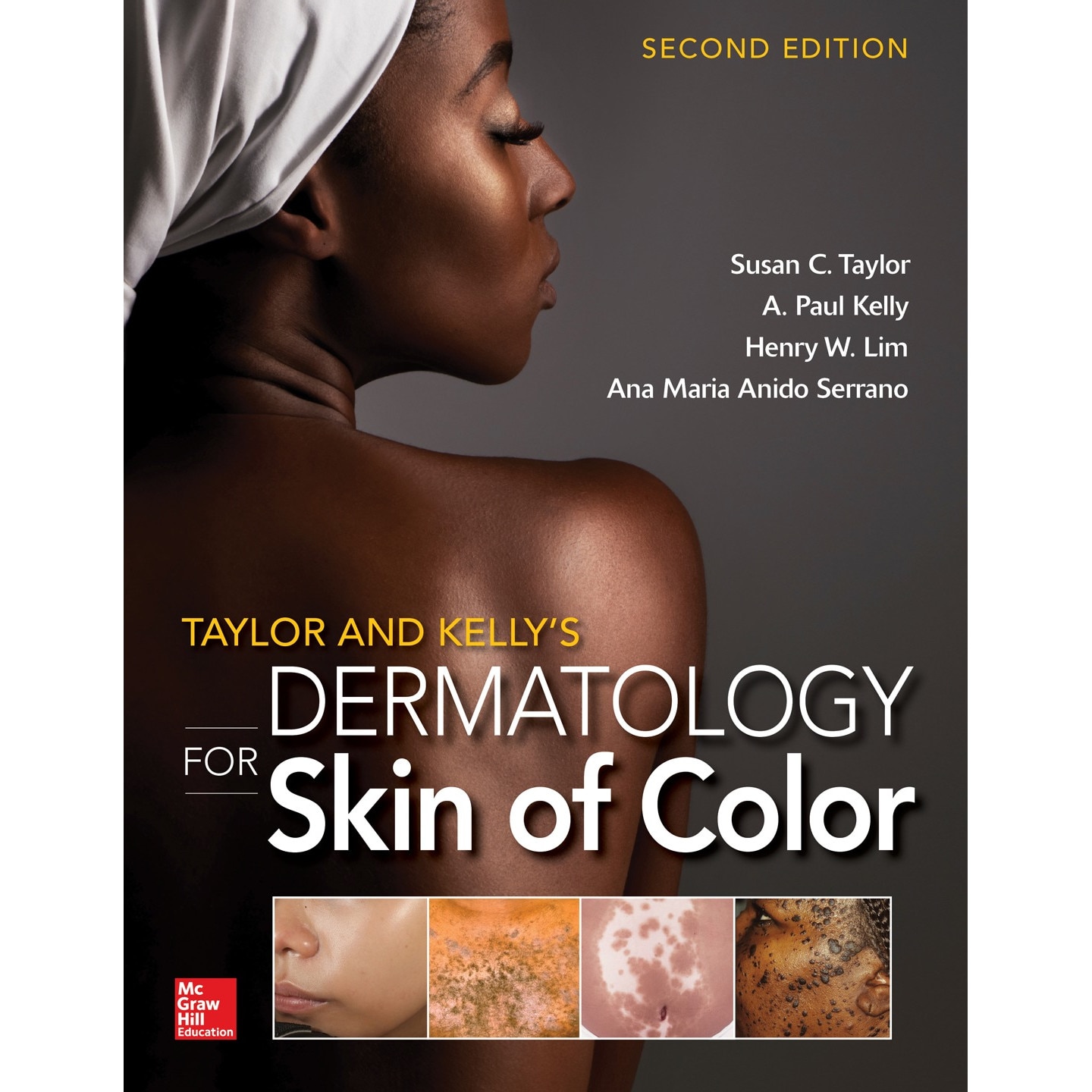 Taylor and Kelly's Dermatology for Skin of Color 2/E de Susan Taylor ...