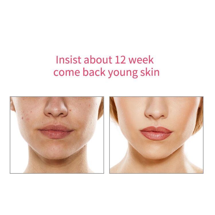 EMS Hot & Cool Skin Care Device, IOIOOO® Масажор за лице, Skin Recovery ...