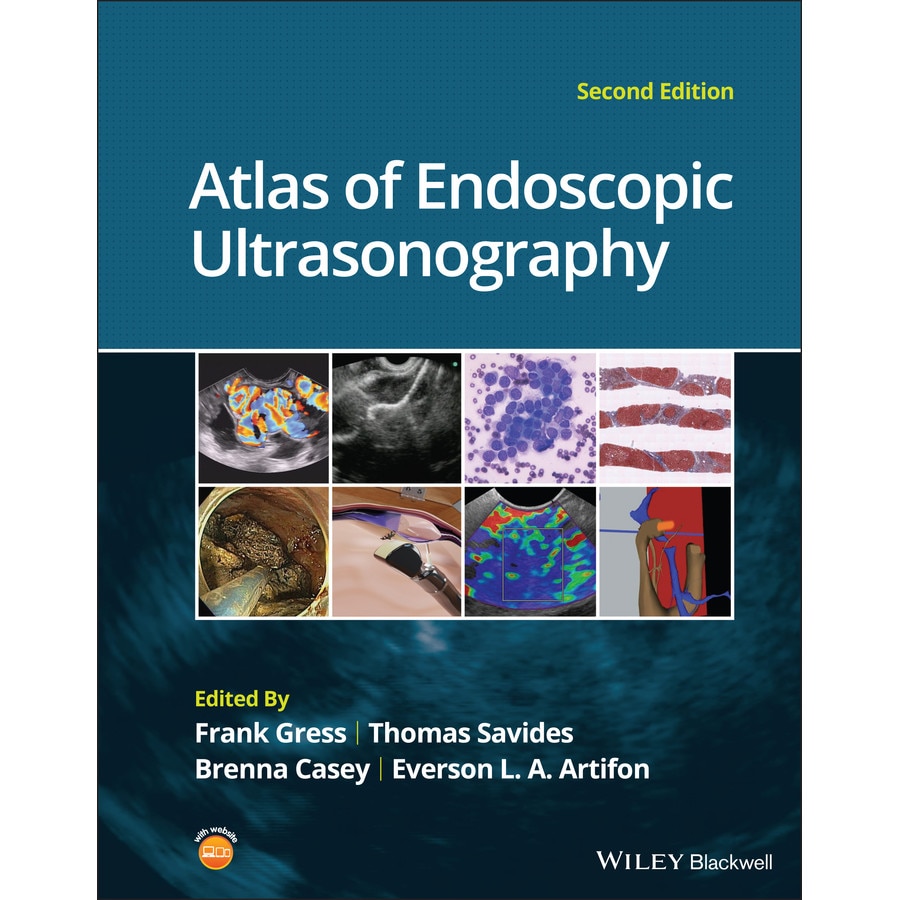 Atlas of Endoscopic Ultrasonography 2e de FG Gress - eMAG.ro