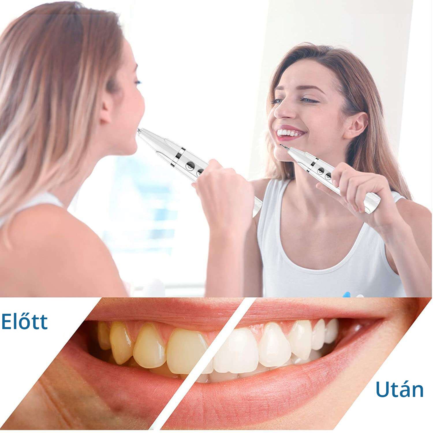 Fogkőeltávolító, Zenkabeat Smart Sonic Pro, 5 üzemmód, ultrahangos ...