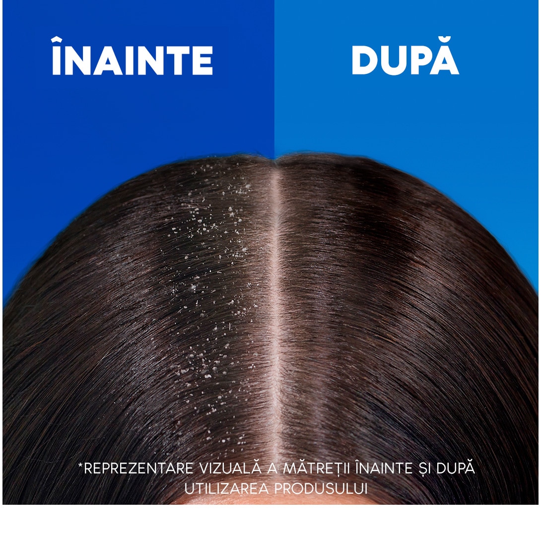 Sampon anti-matreata Head & Shoulders Menthol Fresh pentru orice tip de ...