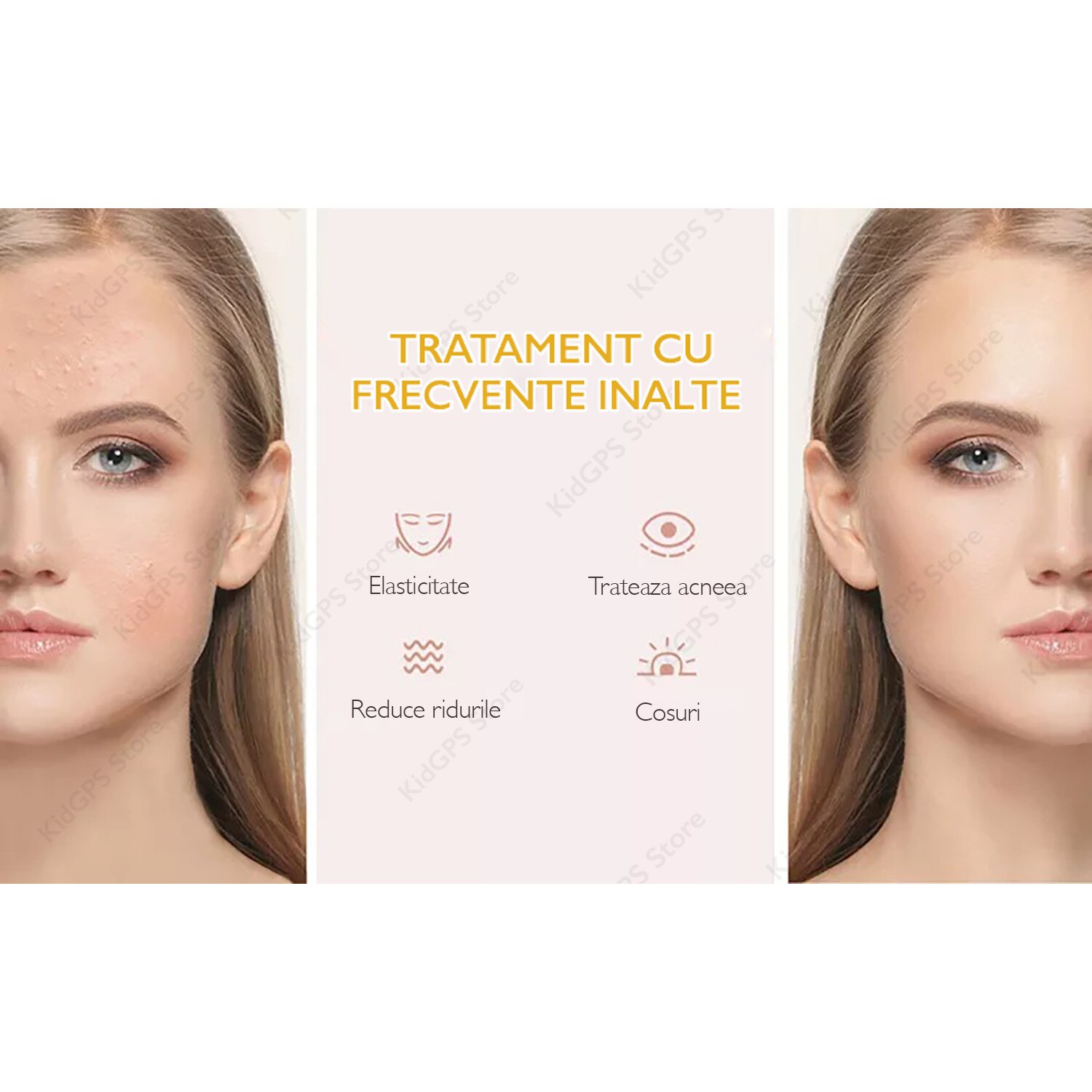 Electroderm Horigen® Dermo Pro, tratament cu frecventa Inalta pentru ...