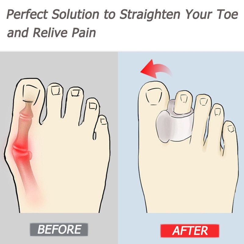 Set 4 separatoare ortopedice pentru degete, Supertina, Silicon, Lavabil ...