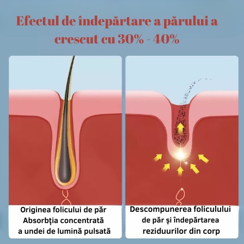 Epilator IPL epilare definitiva fara durere pentru fata, corp, axila ...