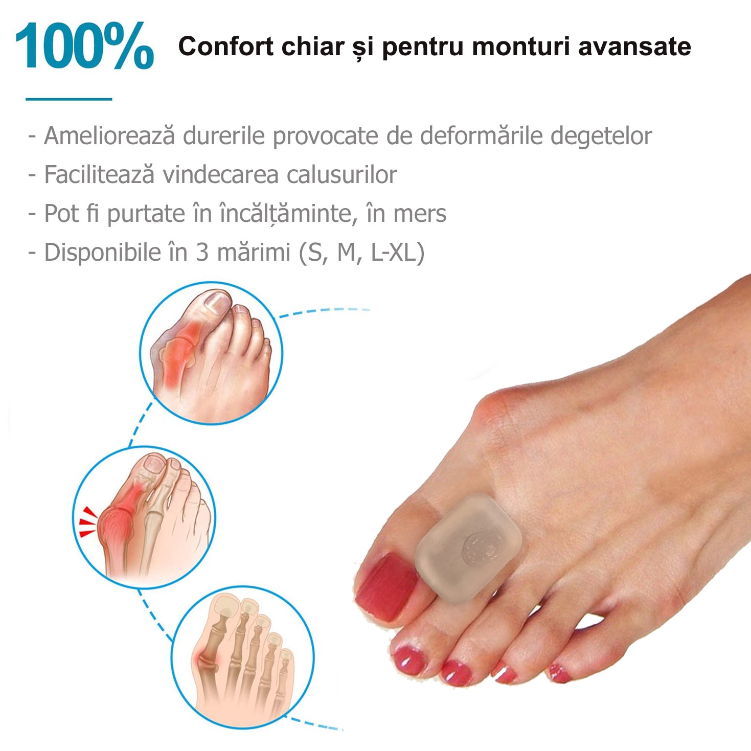 Set 3 distantiere elastice pentru monturi, marimea S, separatoare ...