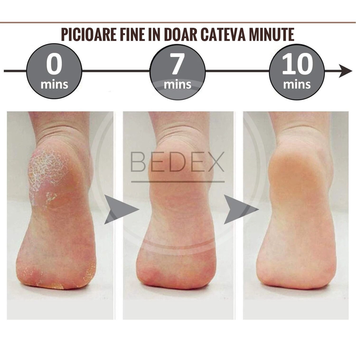 Pila de picioare pentru talpi si calcaie, reincarcabila, rezistenta la ...