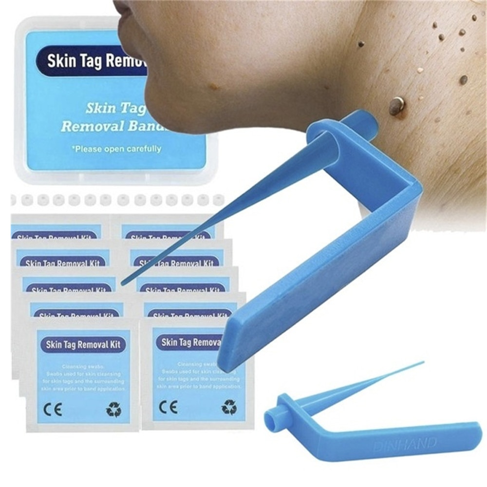 Dispozitiv indepartare papiloame prin strangulare, Skin Tag removal ...