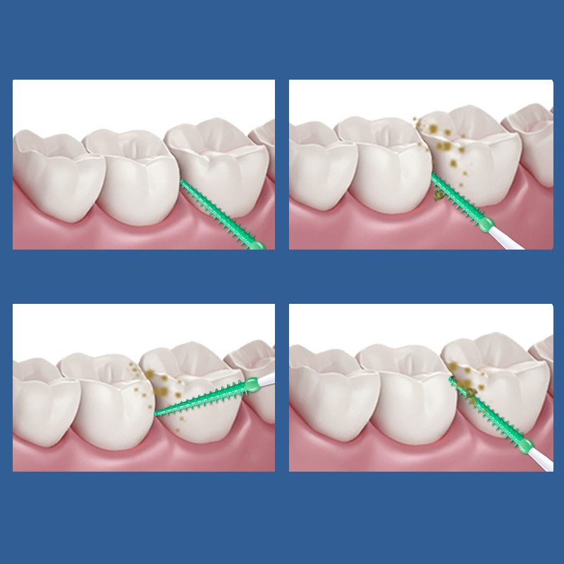 Set 160 periute unica folosinta interdentare, Amtok, Silicon/Plastic ...