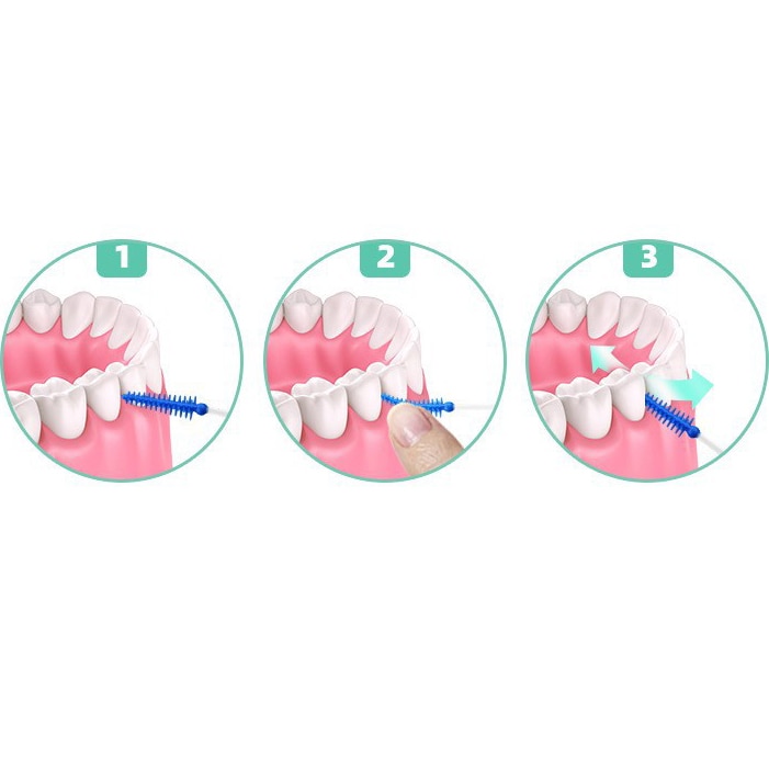 Set 160 periute unica folosinta interdentare, Amtok, Silicon/Plastic ...