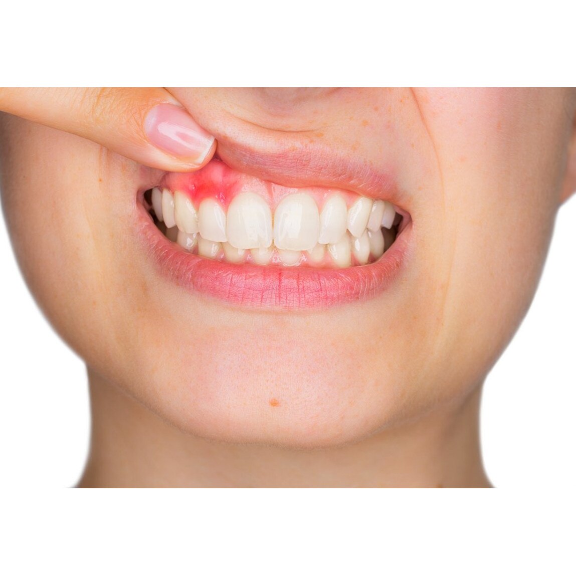 Успокояващ гингивален гел с градински чай и прополис TisoDent, 20 ml ...