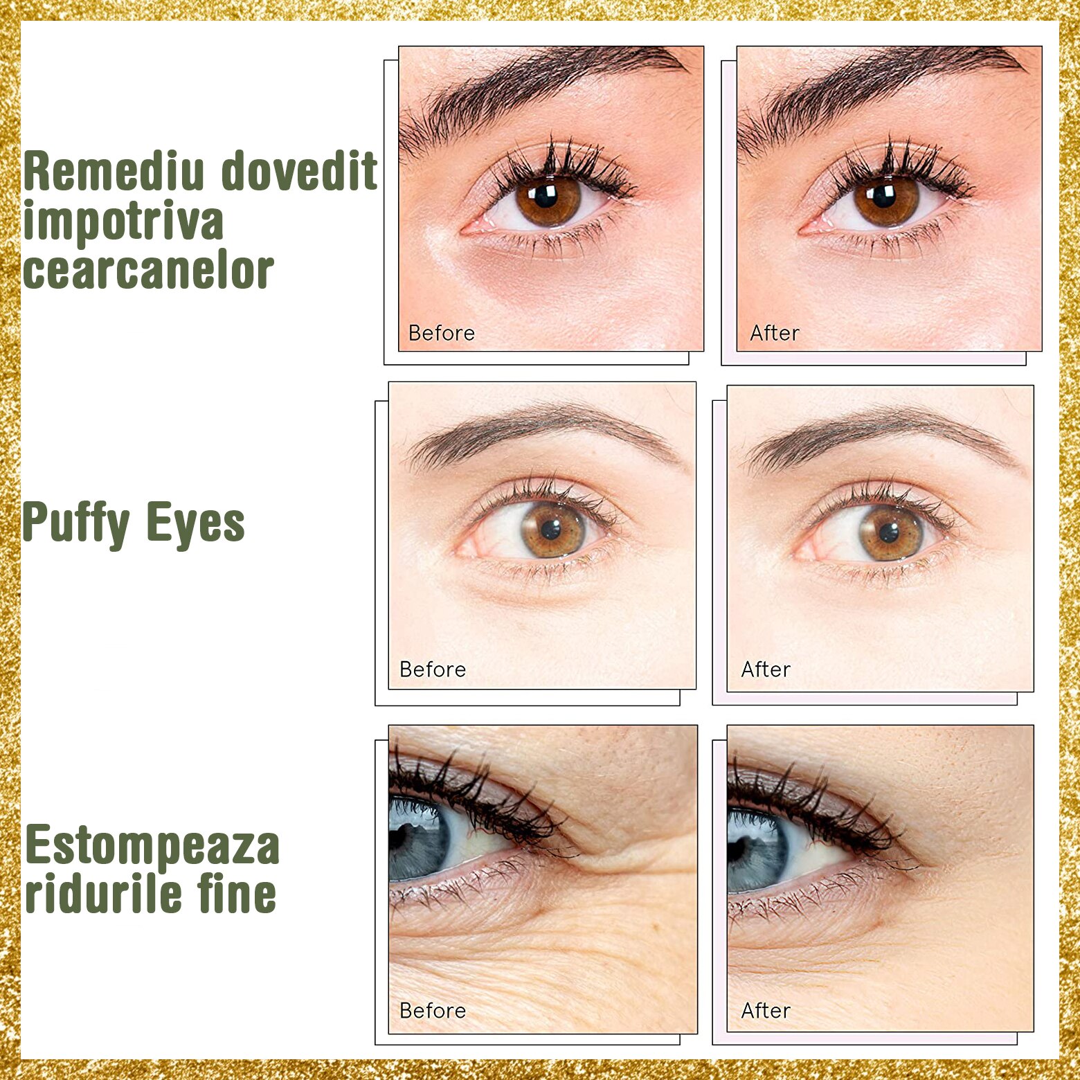 Masca hidratanta, plasturi pentru ochi - AntiCearcan, AntiRiduri, Nano ...