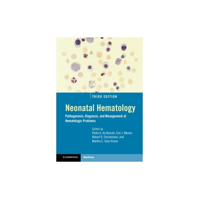 Neonatal Hematology Pathogenesis, Diagnosis, and Management of ...
