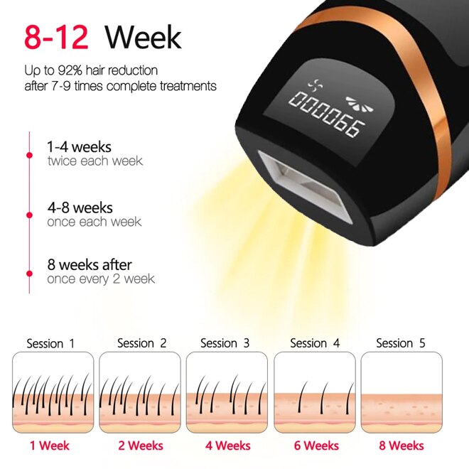 Epilator laser IPL, clasa Premium, 990.000 pulsatii, epilare definitiva ...