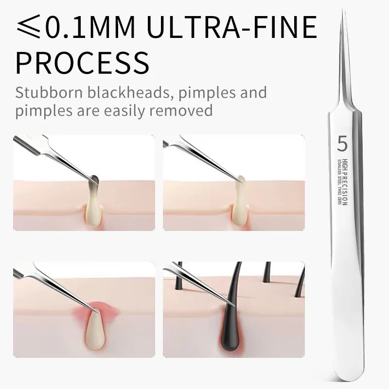 Set 8 pensete pentru extractie puncte negre, comedoane, acnee ...