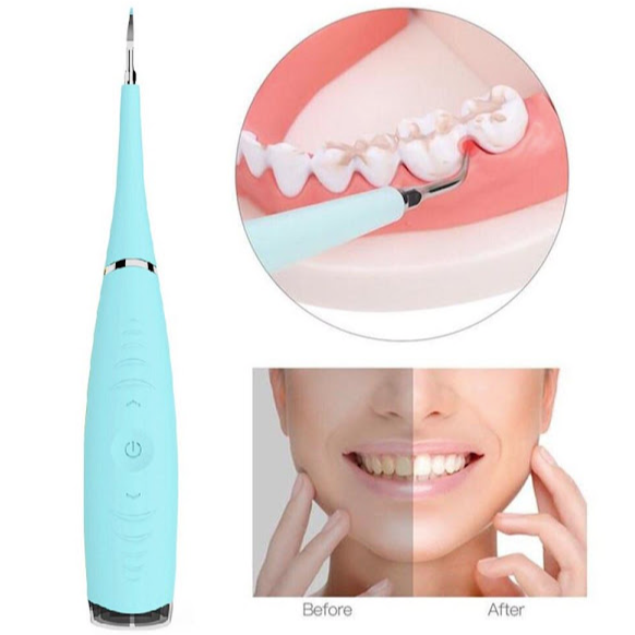 Dispozitiv electric pentru indepartarea depunerilor de tartru - eMAG.ro