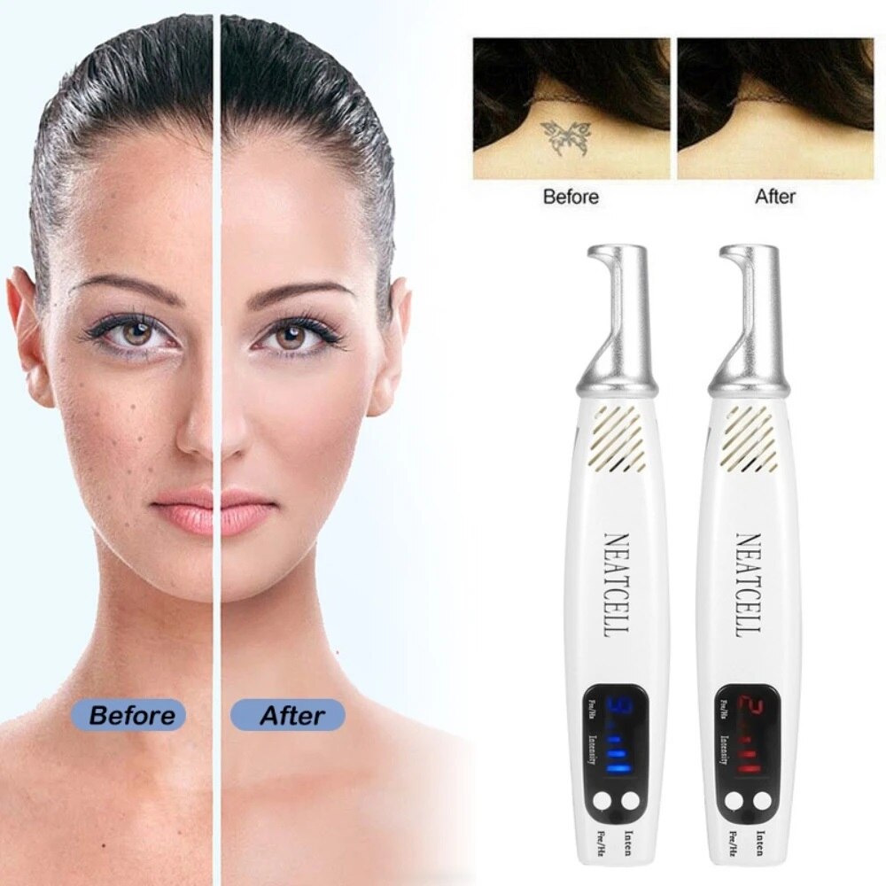 Aparat cu Laser, Lumina Blue Light, Indepartare Tatuaje Colorate ...