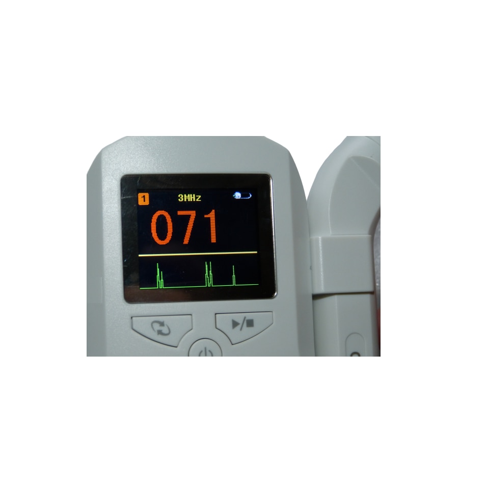 Monitor de ritm cardiac fetal, Ecran LCD, difuzor, forma de unda pentru ...